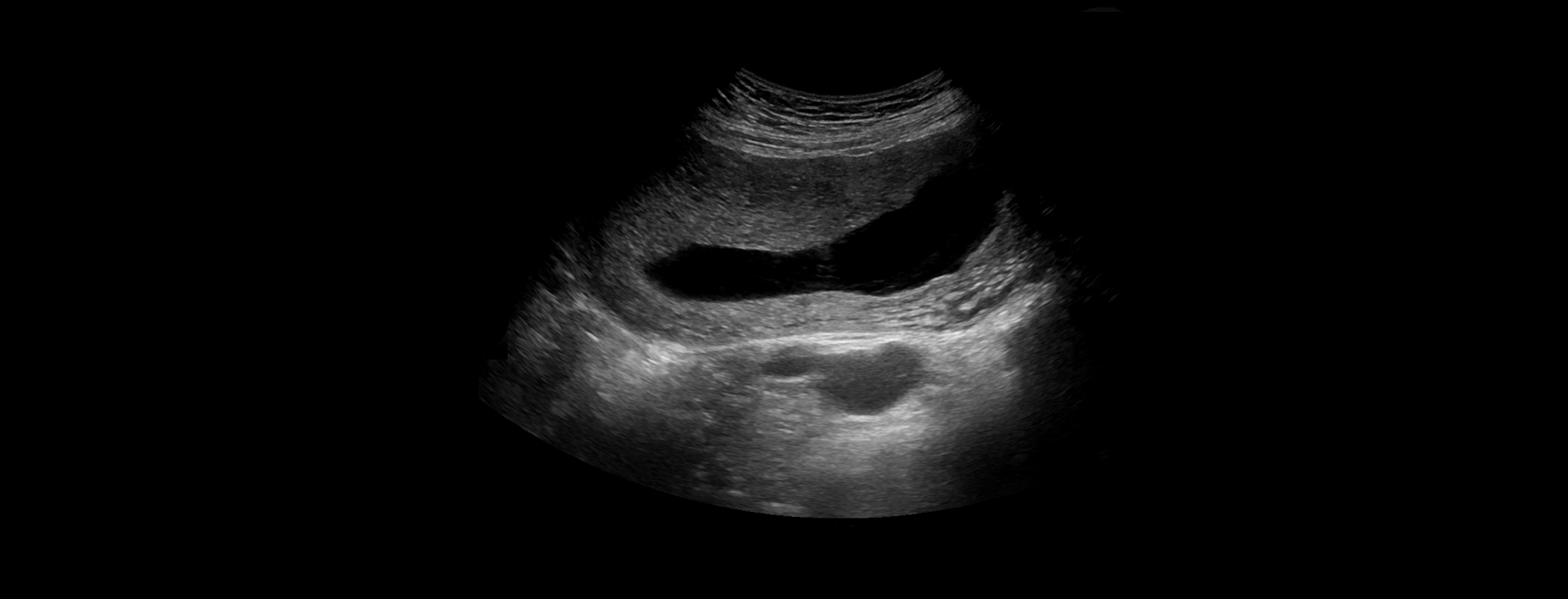 Black Box - Film Independent